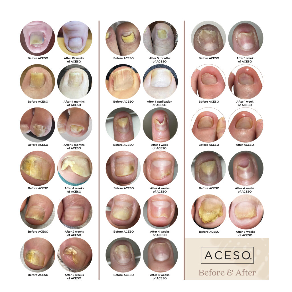 Before and After Using IBX and IBX Repair by Famous Names